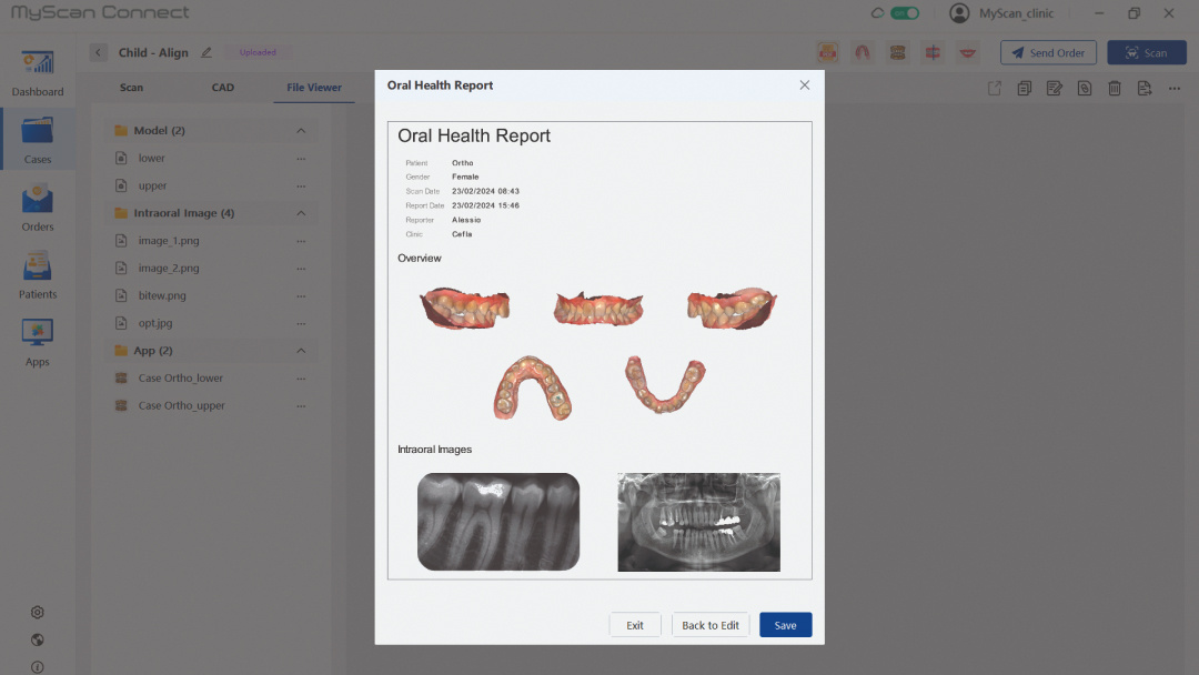 MyScan WL: Precision and Reliability | MyRay